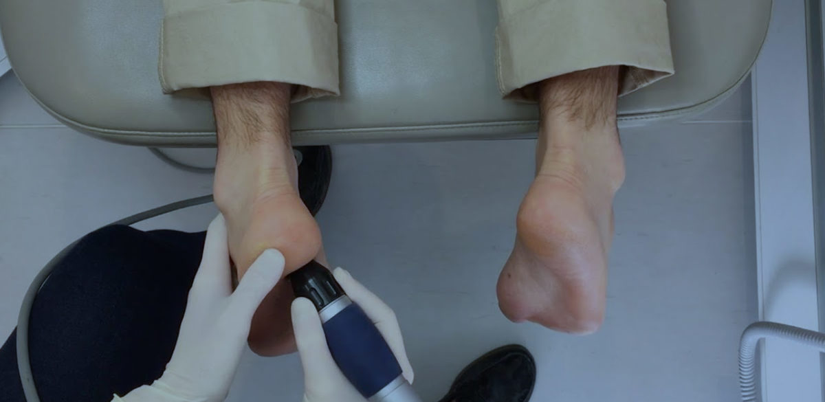 Radial Shockwave Therapy (RSWT) in Bangalore - Optra Care